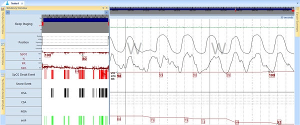 BMC Φορητό Σύστημα Μελέτης Ύπνου Polywatch YH-600Β Pro